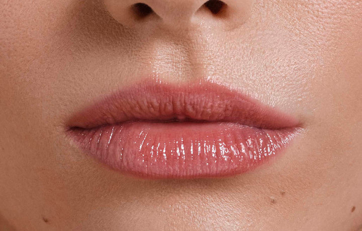 CUPID LIFT® | Deep Plane Upper Lip Lift | What is the CUPID LIFT ...