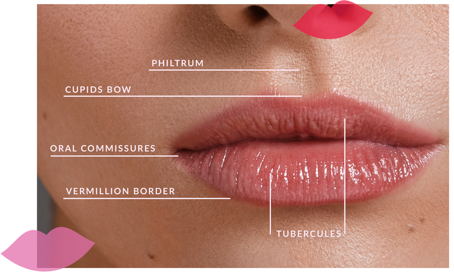 CUPID LIFT® | Deep Plane Upper Lip Lift | What is the CUPID LIFT®? – CUPID LIPS®