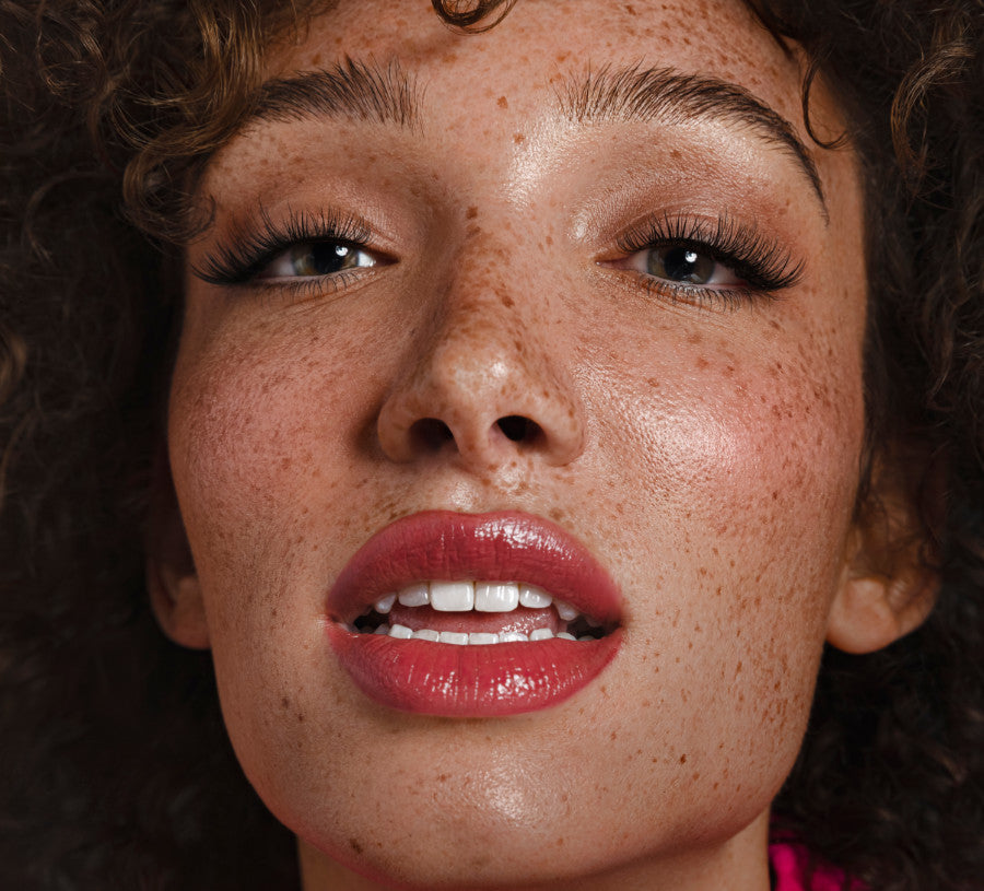 CUPID LIFT® | Deep Plane Upper Lip Lift | What is the CUPID LIFT ...